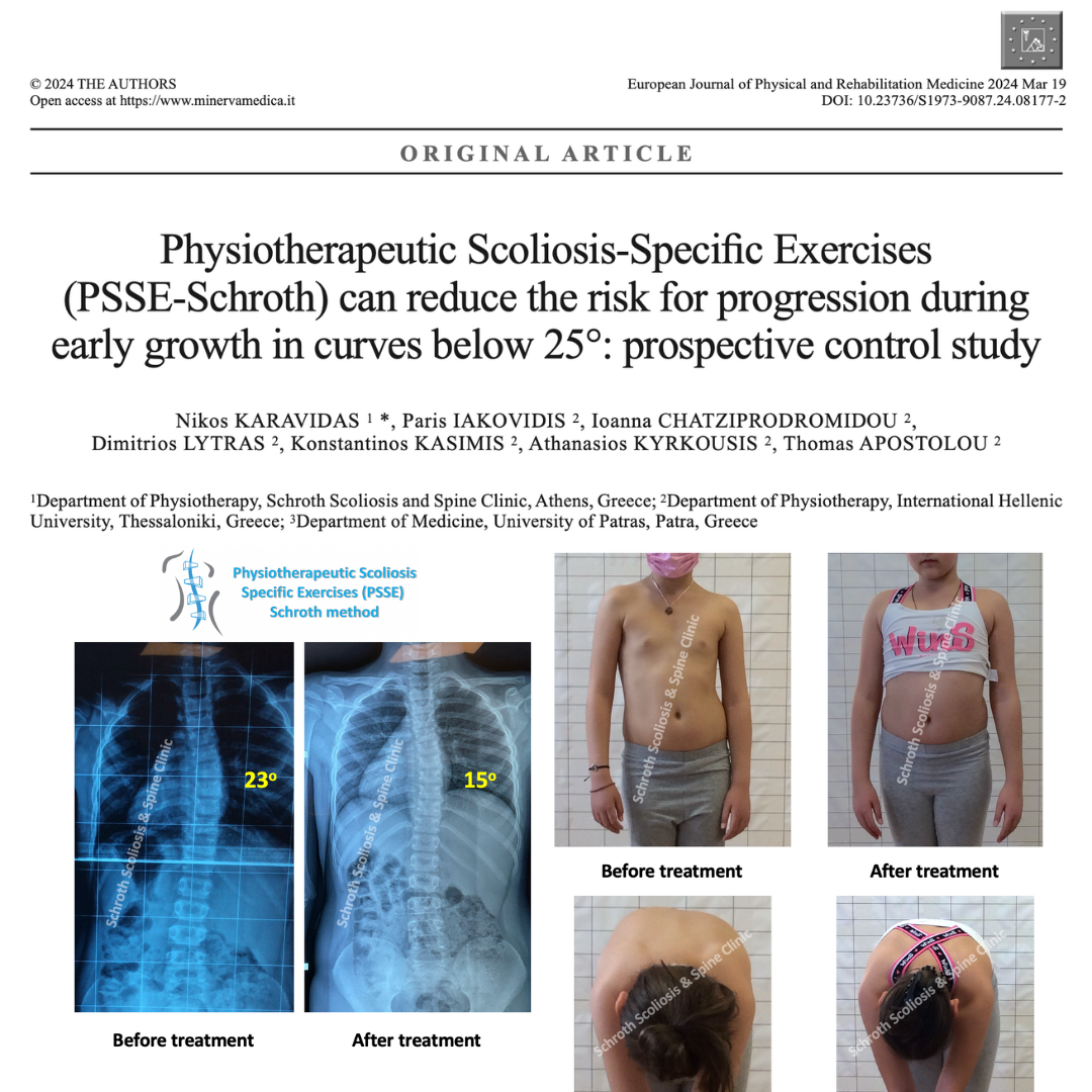 Δημοσίευση έρευνας του Νίκου Καραβίδα: "Physiotherapeutic Scoliosis ...